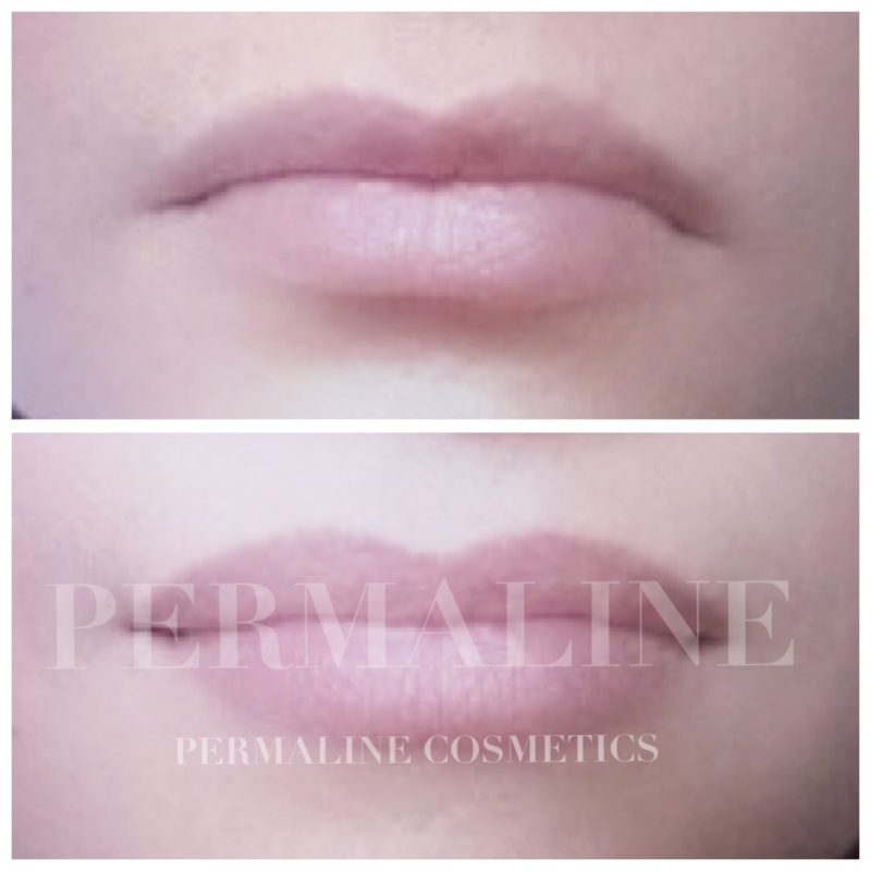 Permaline cosmetics before and after lip filler. - Permanent Makeup ...